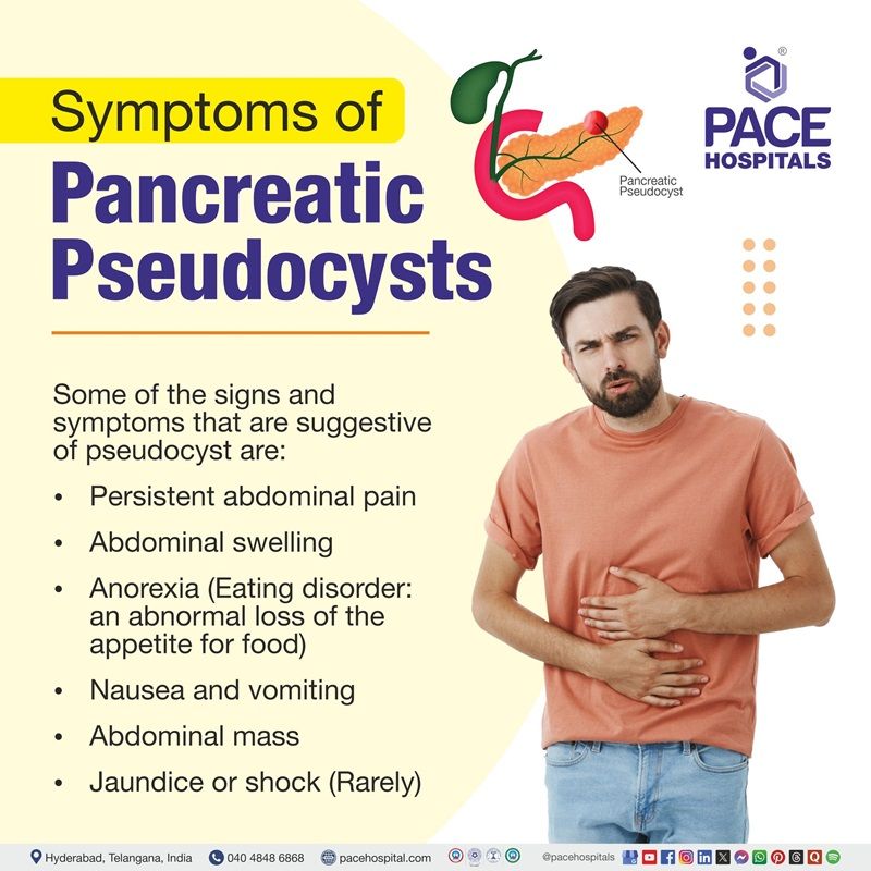 Pancreatic Pseudocyst: Symptoms, Causes, Treatment & Prevention
