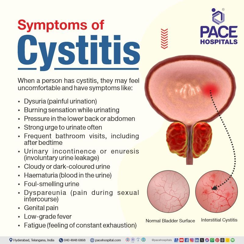 Cystitis: Types, Symptoms, Causes, Prevention & Treatment
