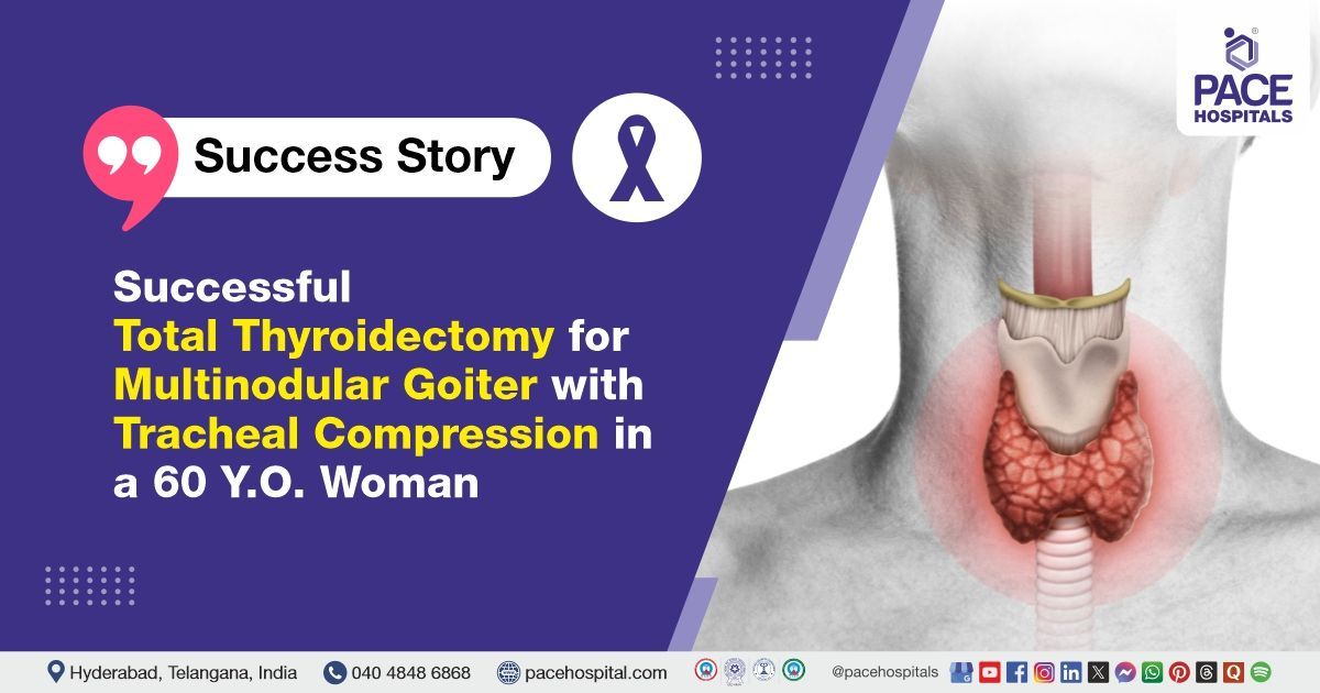 Multinodular Goiter Treatment via Total Thyroidectomy Surgery