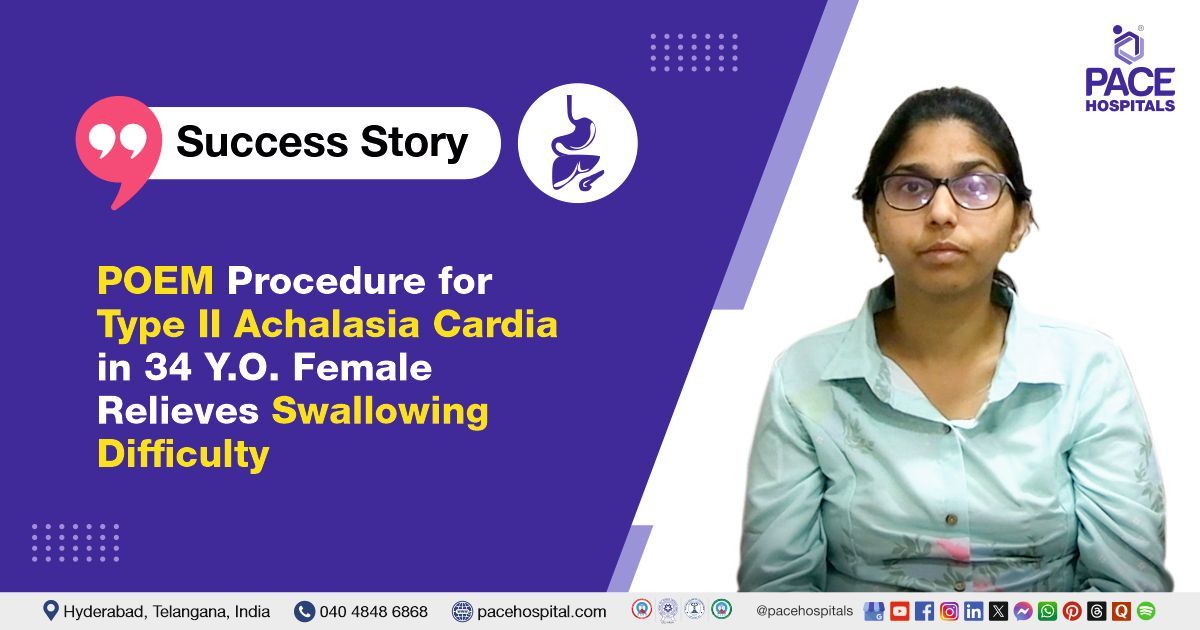 Effective POEM Procedure for Type II Achalasia Cardia Treatment