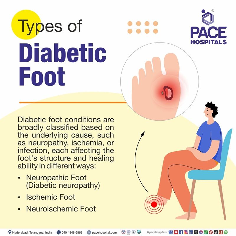 Diabetic Foot: Symptoms, Causes, Complications & Treatment
