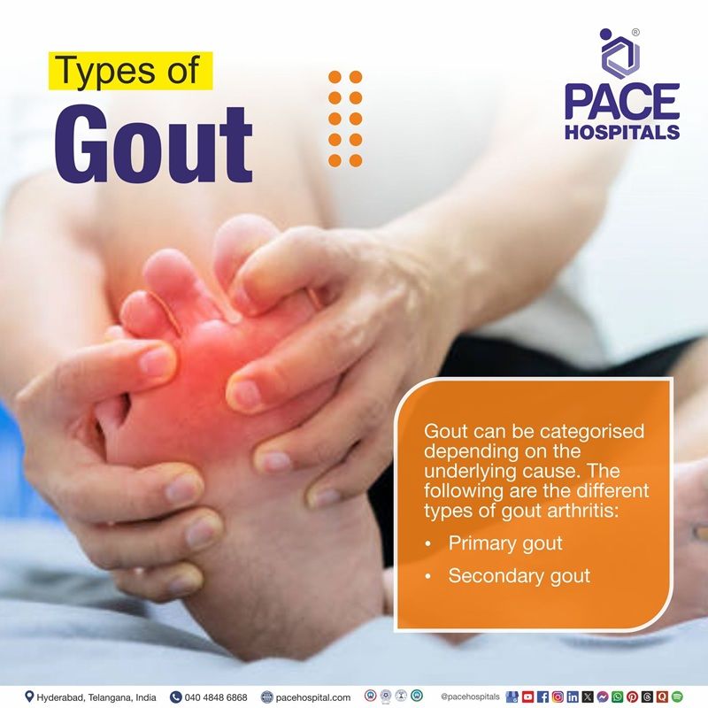 Gout: Symptoms, Causes, Diagnosis, Treatment & Prevention
