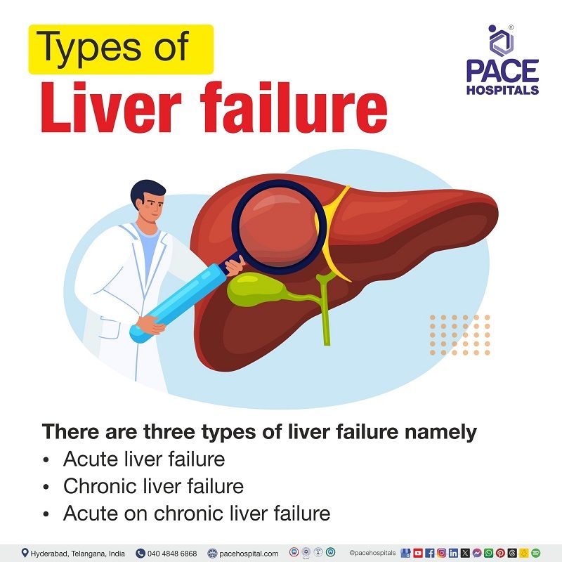 Liver Failure - Symptoms, Causes, Types and Treatment