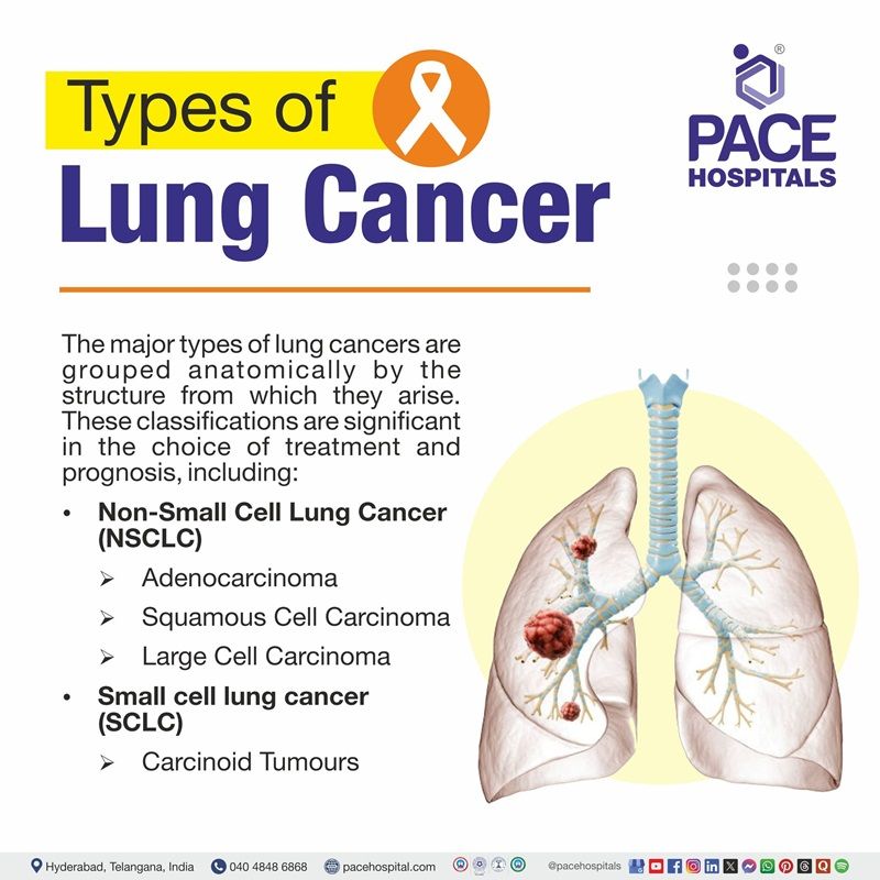 Lung Cancer: Causes, Symptoms, Stages, Treatment, Prevention