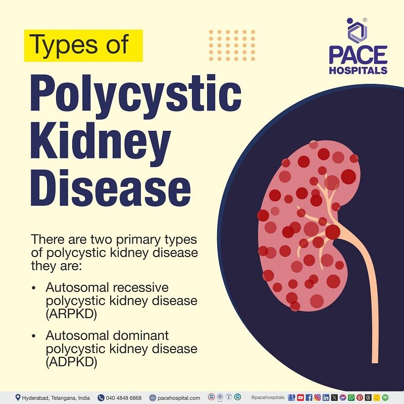 Polycystic kidney disease - Symptoms, Causes, Types,Treatment