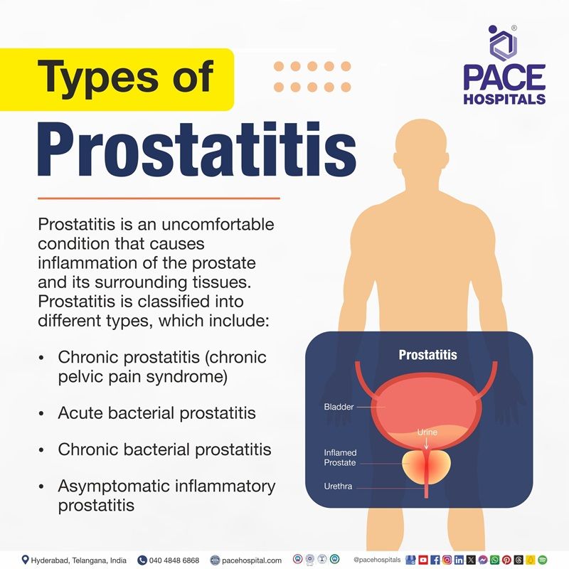 Prostatitis - Causes, Symptoms, Treatment and Prevention