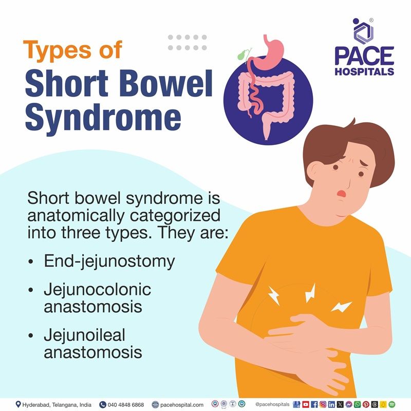 Short Bowel Syndrome - Causes, Symptoms , Treatment, Diagnosis