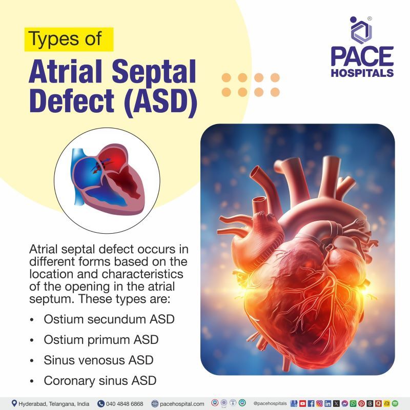 Atrial Septal Defect (ASD): Types, Symptoms, Causes & Treatment