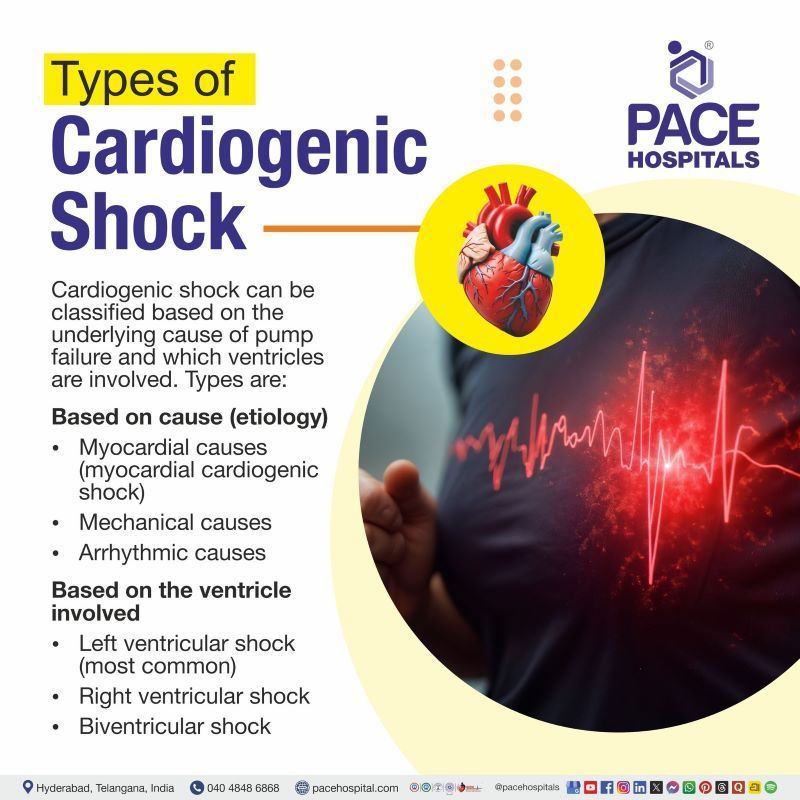 Cardiogenic Shock: Types, Symptoms, Causes & Treatment