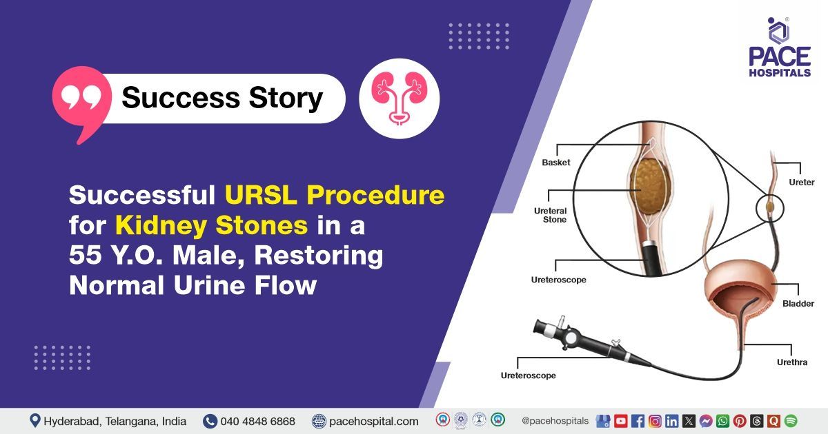 URSL Procedure with DJ stenting for Kidney Stones Treatment