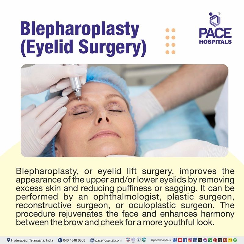 Best Hospital for Eyelid Surgery in Hyderabad | Blepharoplasty