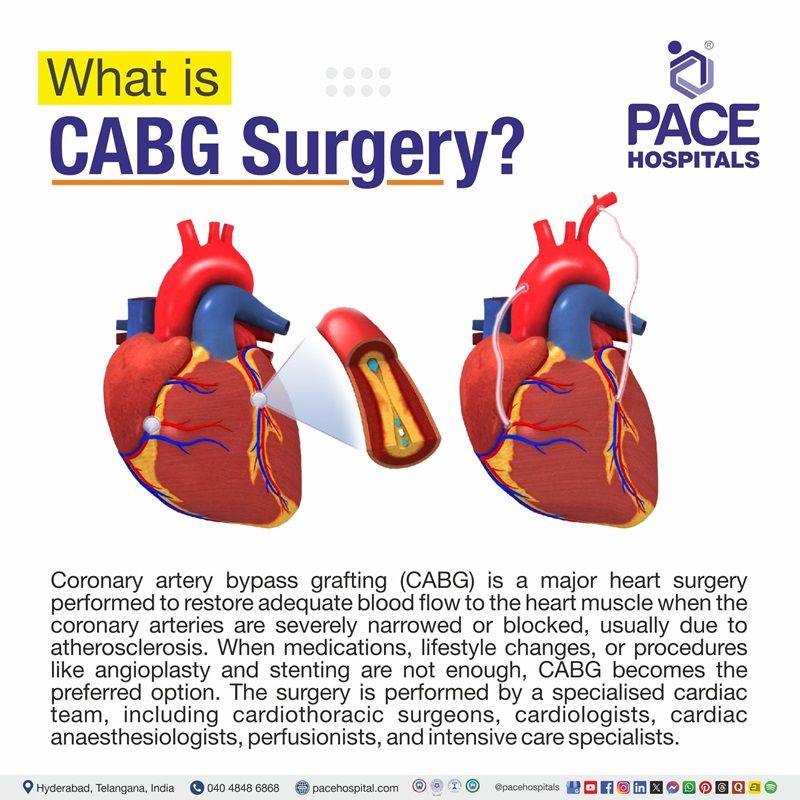 Best Hospital for Heart Bypass Surgery in Hyderabad, India