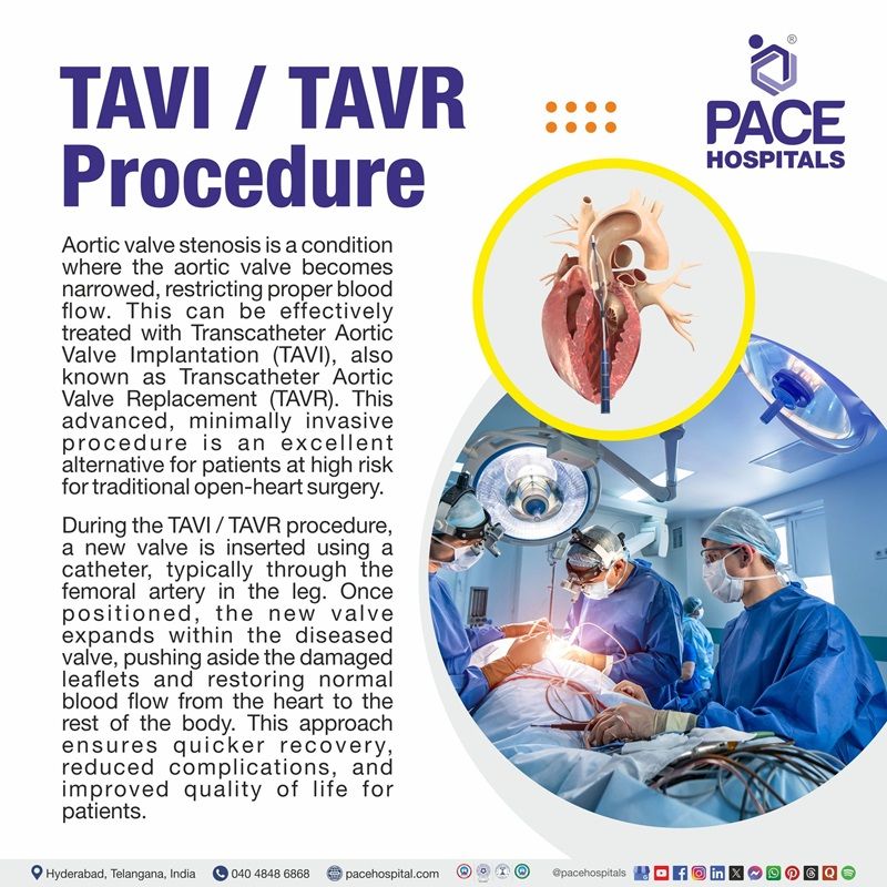 Best TAVI/TAVR Procedure in Hyderabad, India