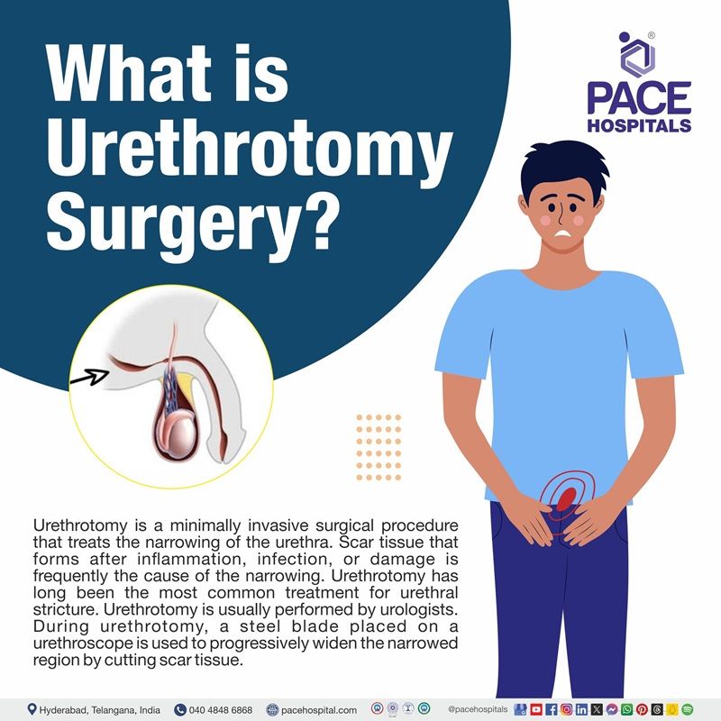 Best Urethrotomy Surgery in Hyderabad | Cost & Benefits