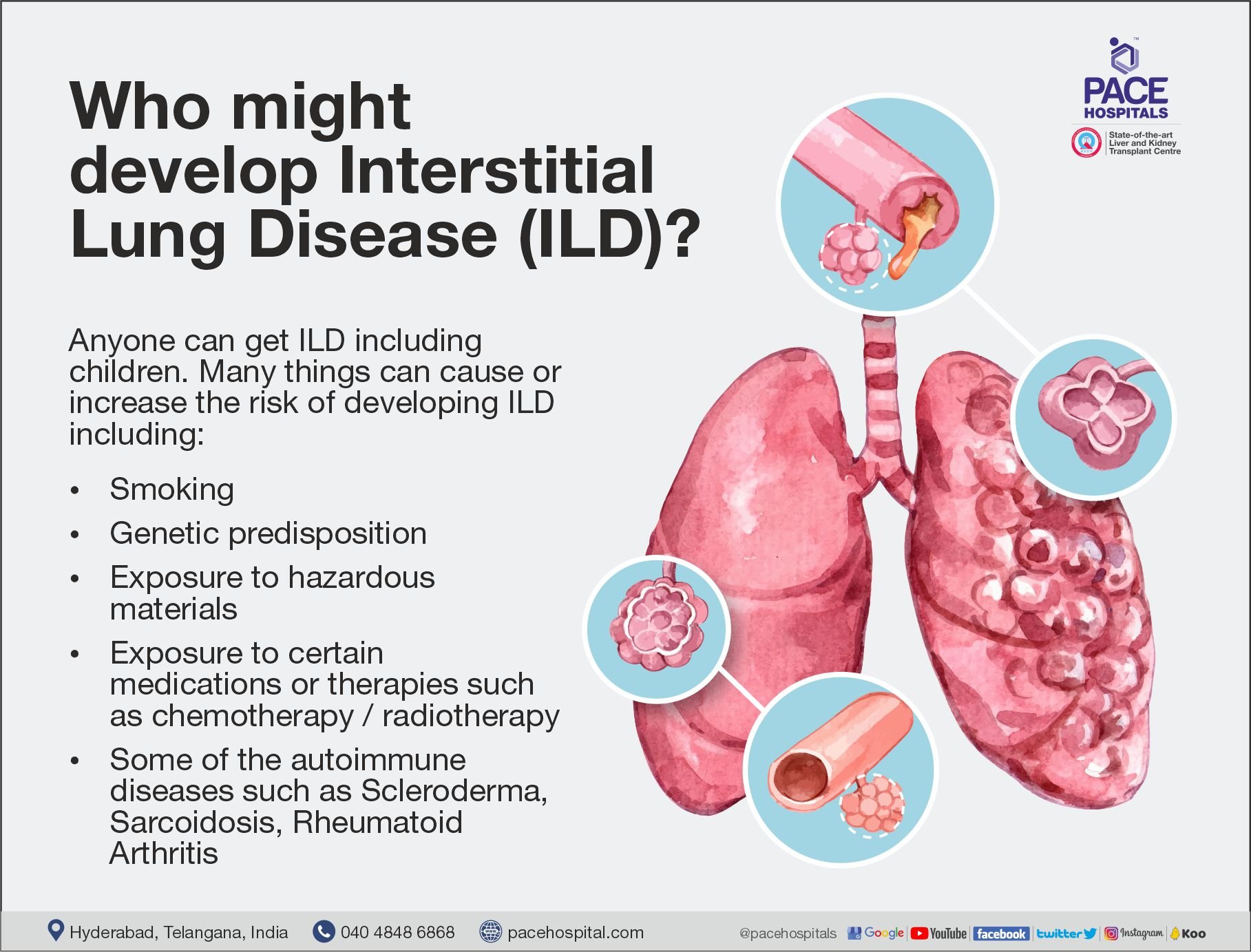 7 Types Of Lung Infections: Symptoms, Causes, And Treatments – RHXRZI