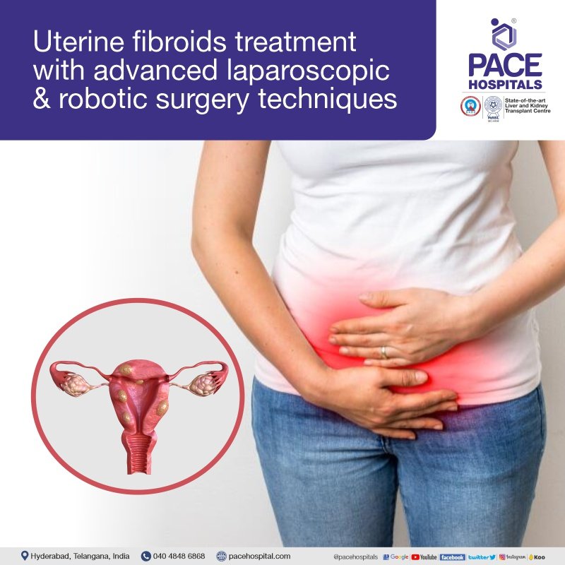 Best Hospital for Uterine Fibroids Treatment in Hyderabad - Surgery