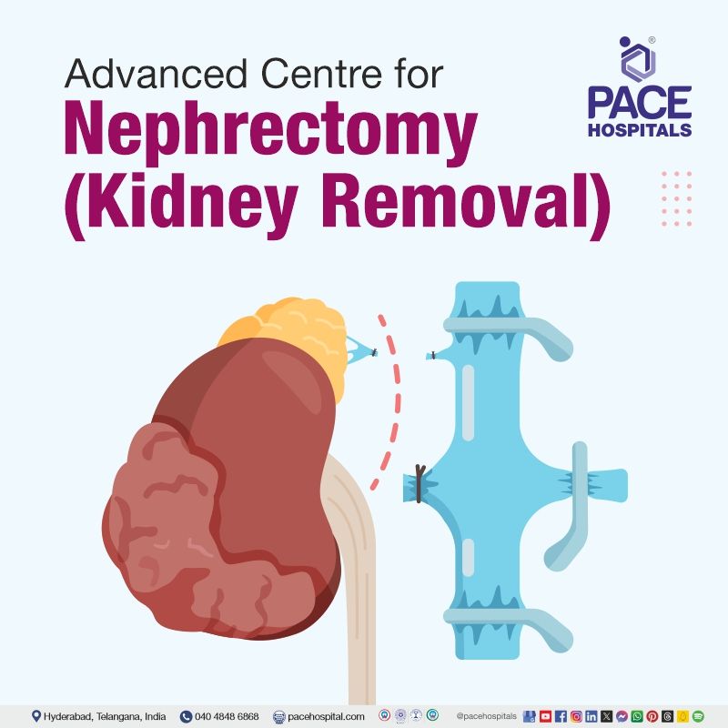 Best Hospital for Nephrectomy Surgery in Hyderabad, India
