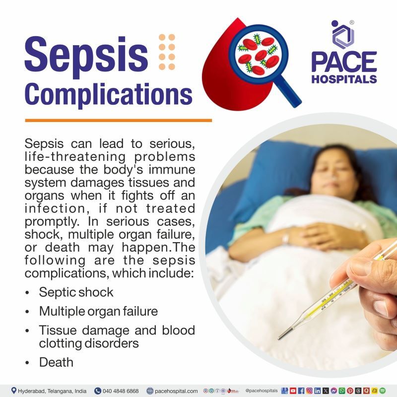 Sepsis: Symptoms, Causes, Diagnosis, Treatment & Prevention