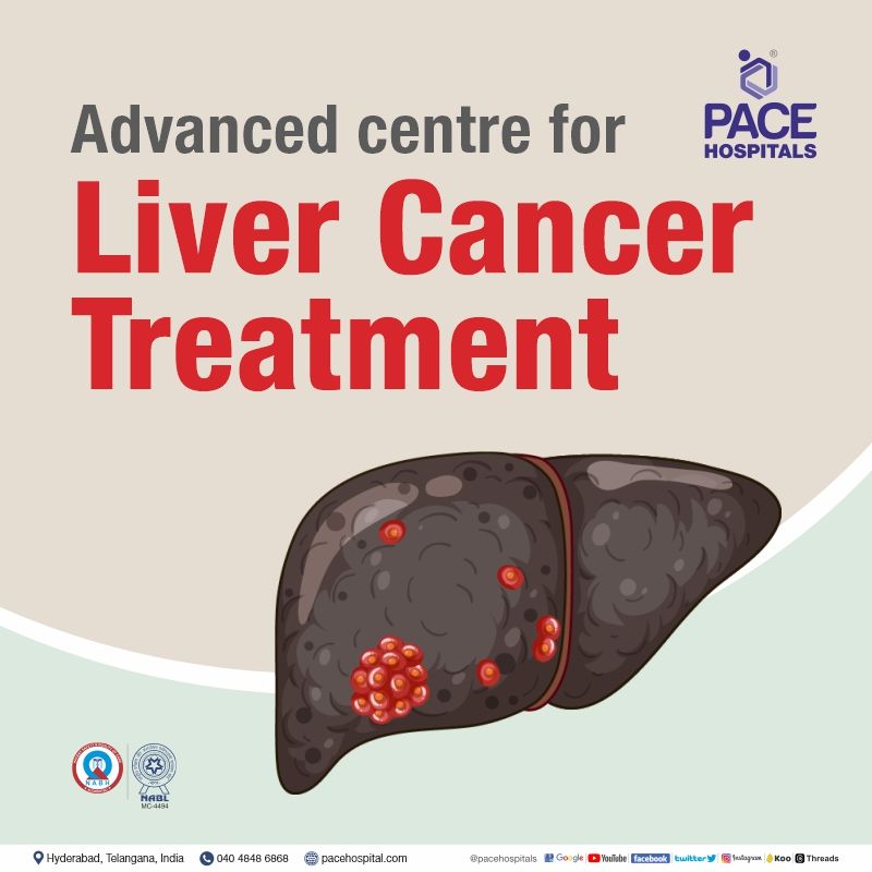 Best Hospital for Liver Cancer Treatment in Hyderabad, India