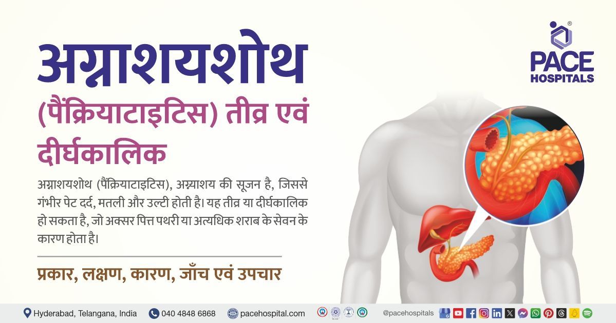अग्नाशयशोथ (पैंक्रियाटाइटिस) - प्रकार, लक्षण, कारण, जाँच, उपचार