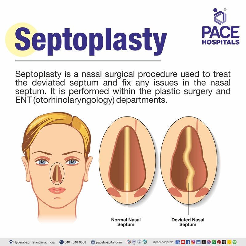 Best Septoplasty Surgery in Hyderabad | Cost & Benefits