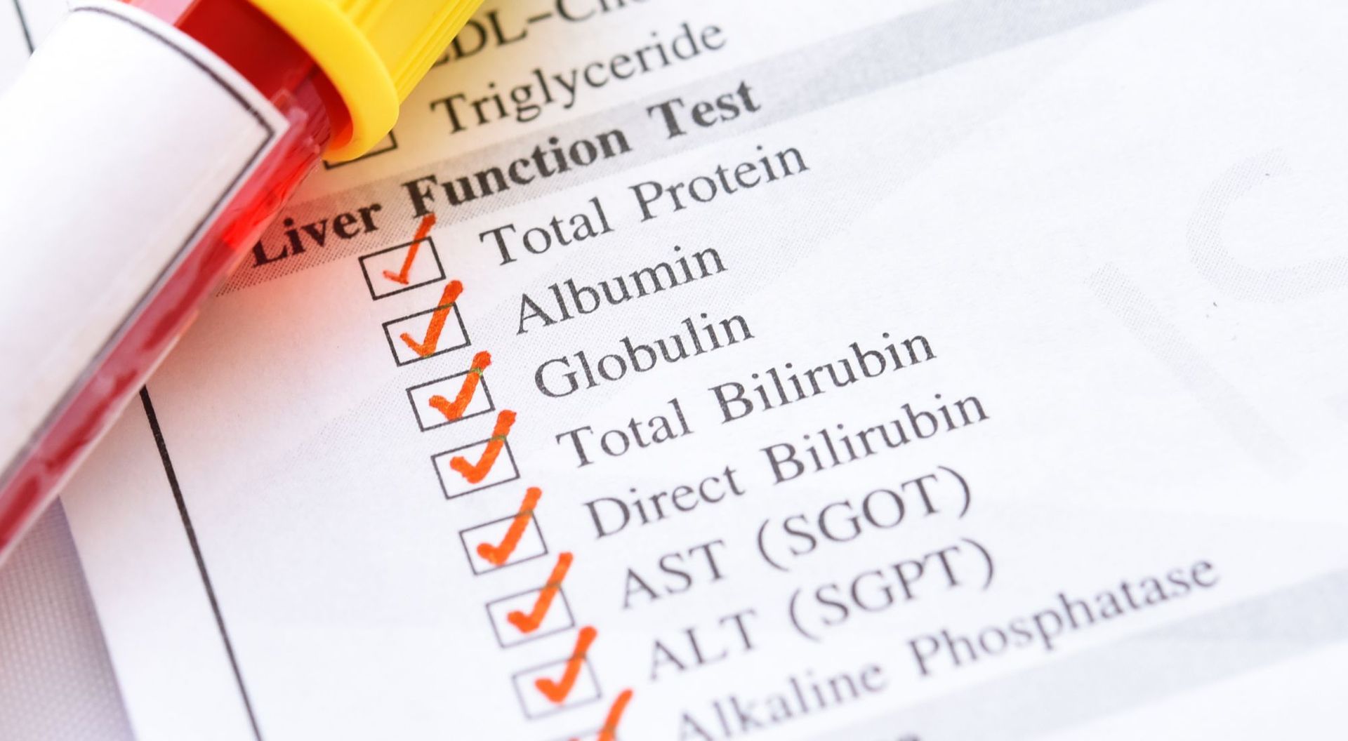 Can Hypothyroidism Affect ALT and AST Levels?