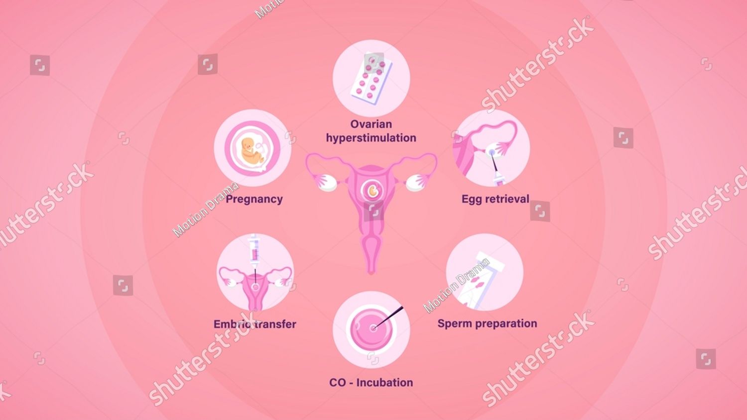 In Vitro Fertilization Fascinating Procedure Of Ivf Explained