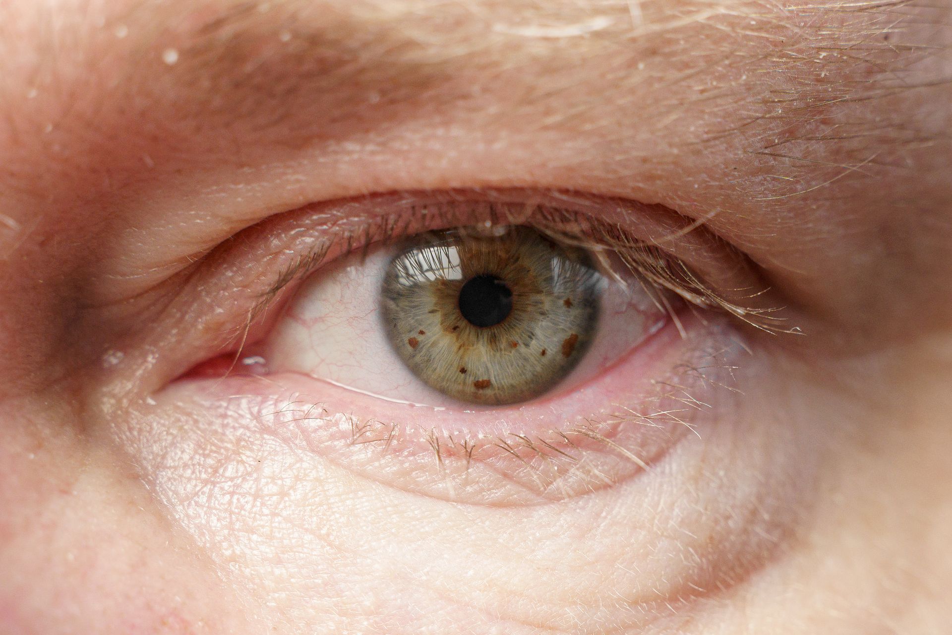 Quanto tempo para recuperar a visão após o transplante de córnea?