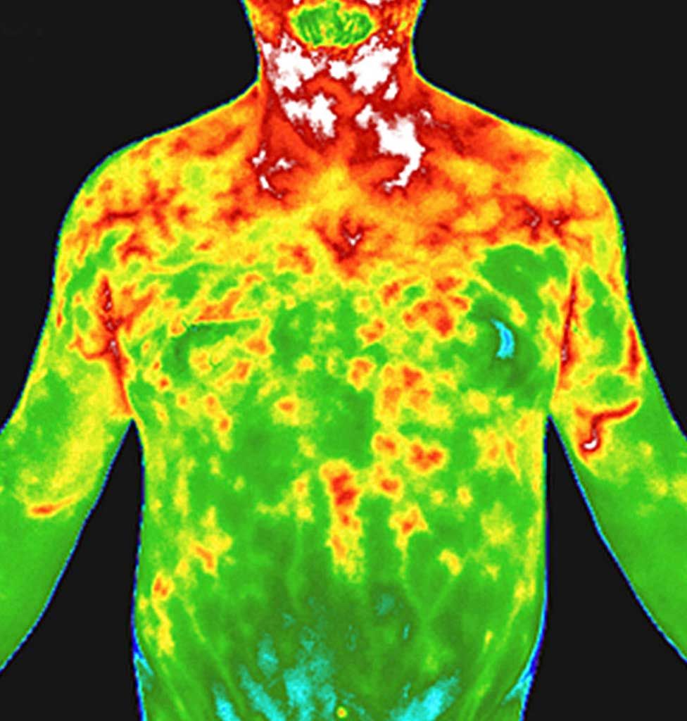 Home - Choice Thermography and Wellness Center