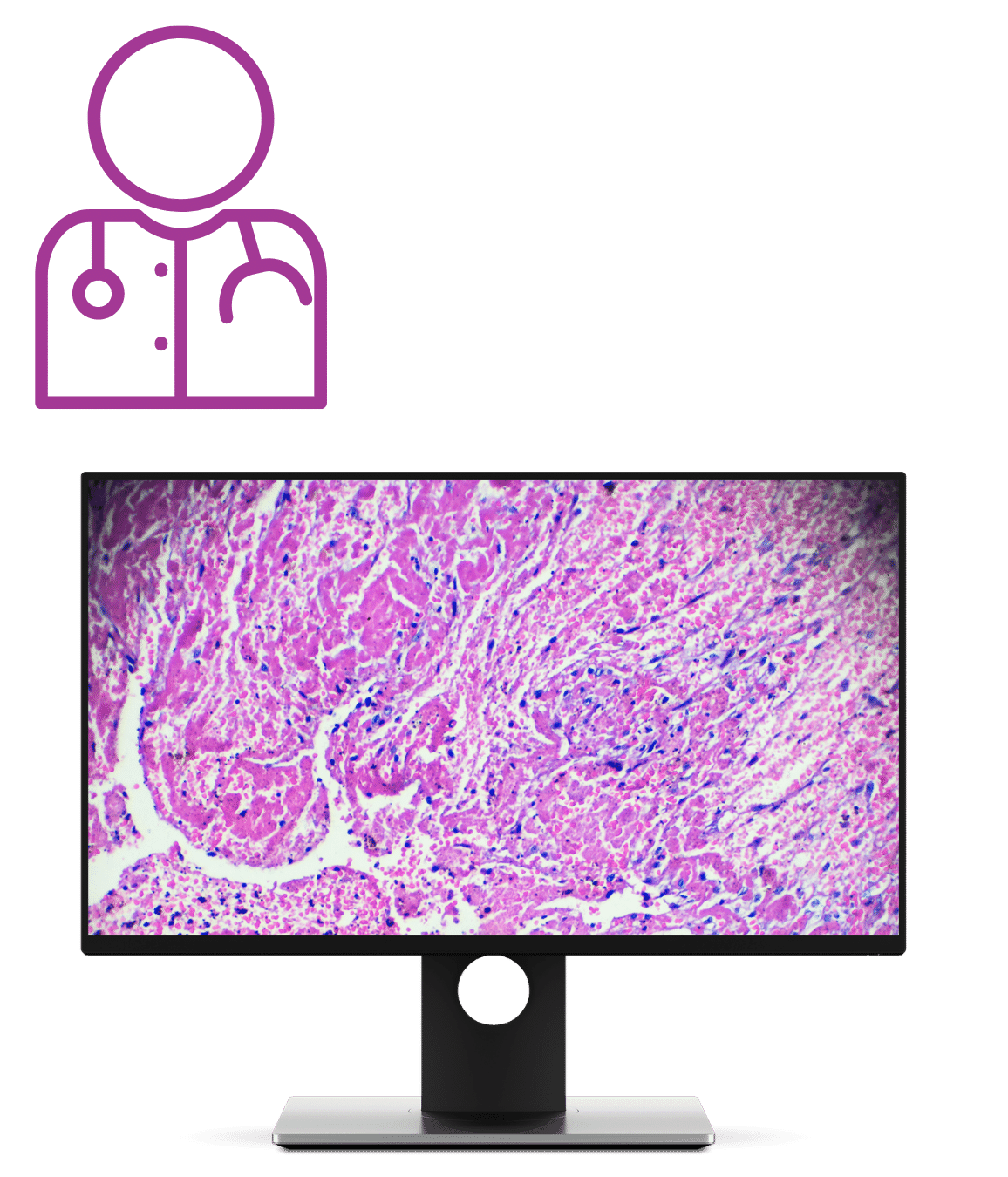 Gestalt's Digital Pathology Software Pathflow®