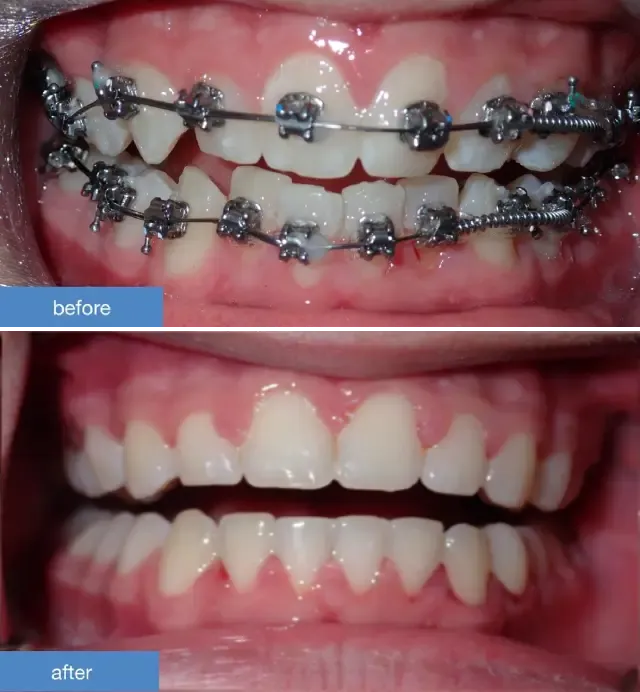 Dental Technology | Riverlands Dental | North Richmond | Hawkesbury