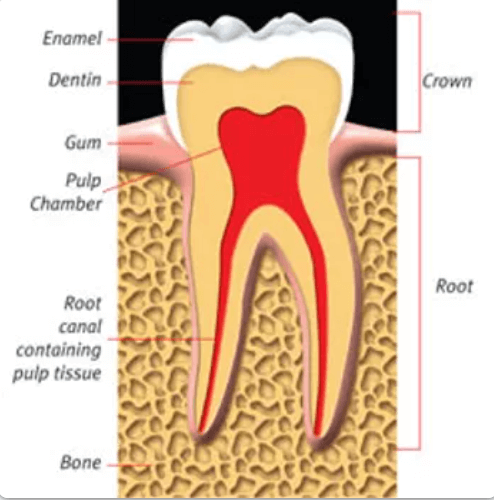 Root Canal Treatment | Maple Ridge Dentist | Dewdney Dental Centre