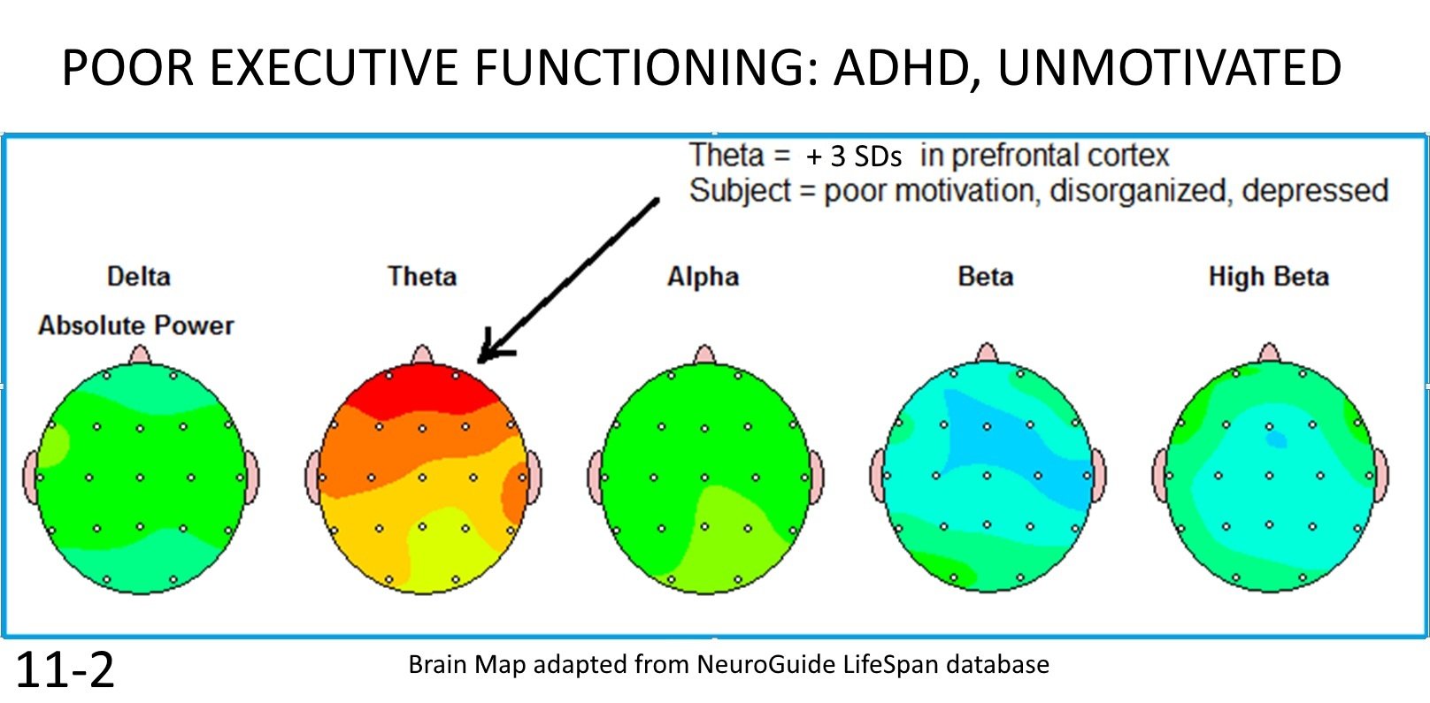 Neurofeedback Training | Neurofeedback Professional Training LLC