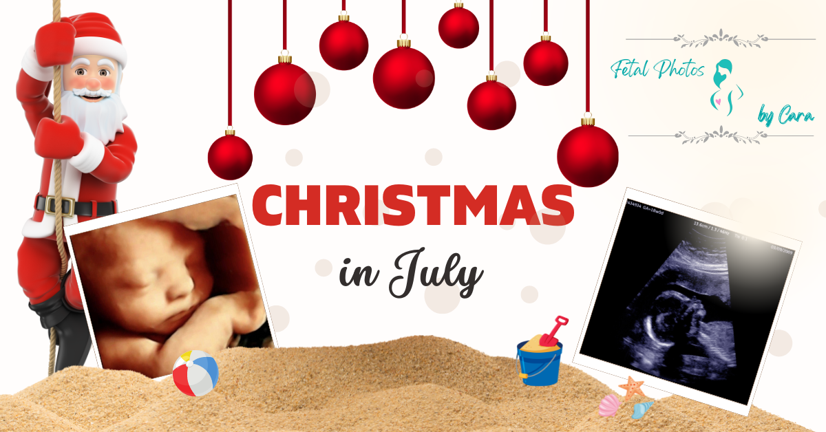 July is a Perfect Time for a Fetal Elective Ultrasound!