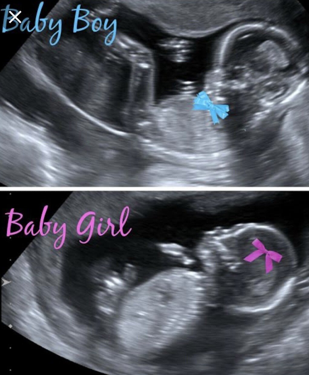 Packages | Fetal Photos by Cara