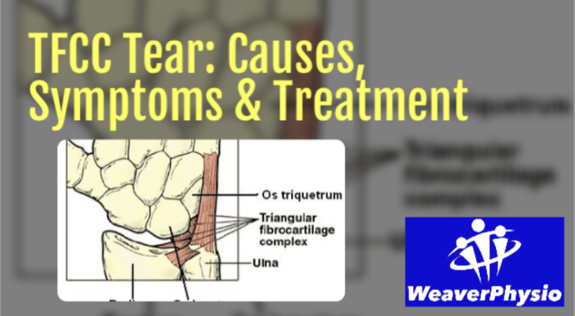 TFCC Tear: Causes, Symptoms & Treatment