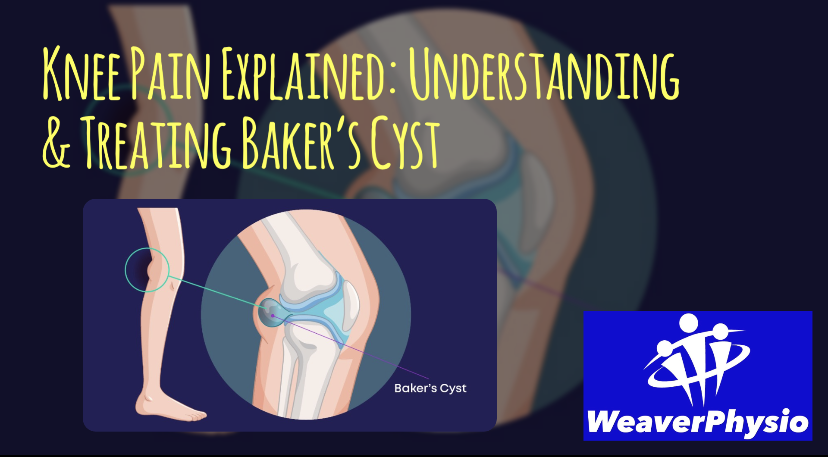 Knee Pain Explained: Understanding & Treating Baker’s Cyst