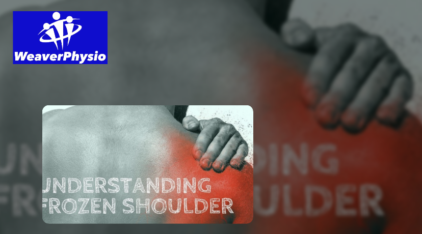 Understanding Frozen Shoulder