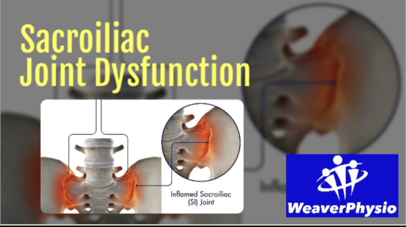 Sacroiliac Joint Dysfunction