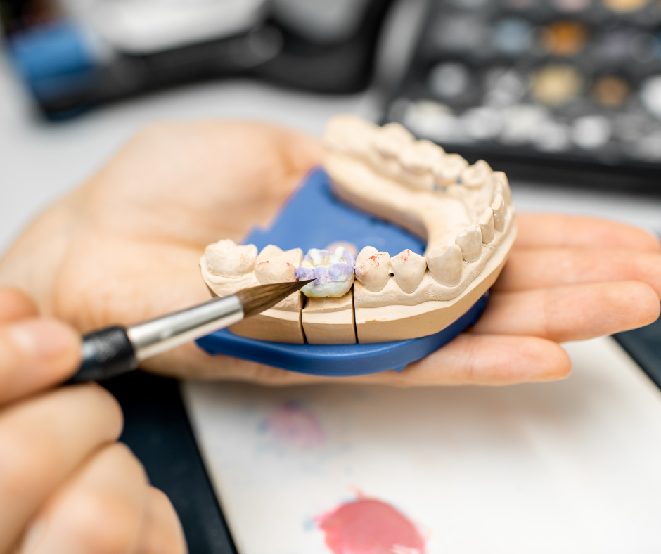Tooth-Colored Restorations & Fillings | Stephens Dentistry
