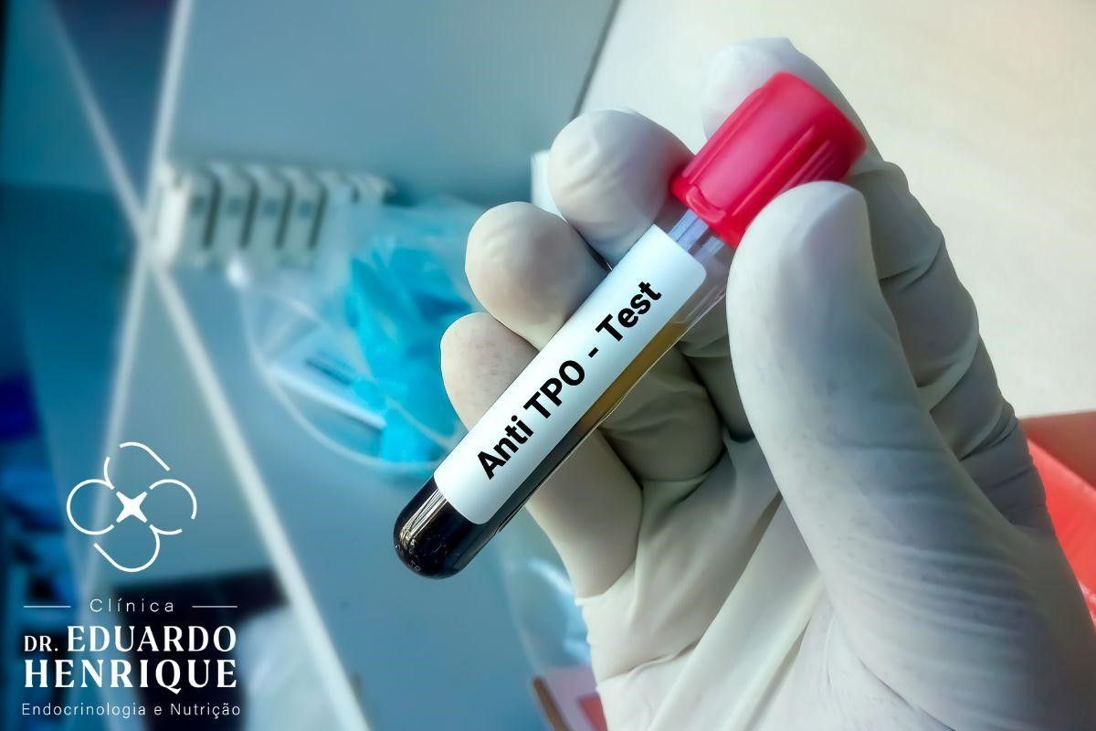 Exame de Anticorpos Antiperoxidase (Anti-TPO): descubra como ele pode ...