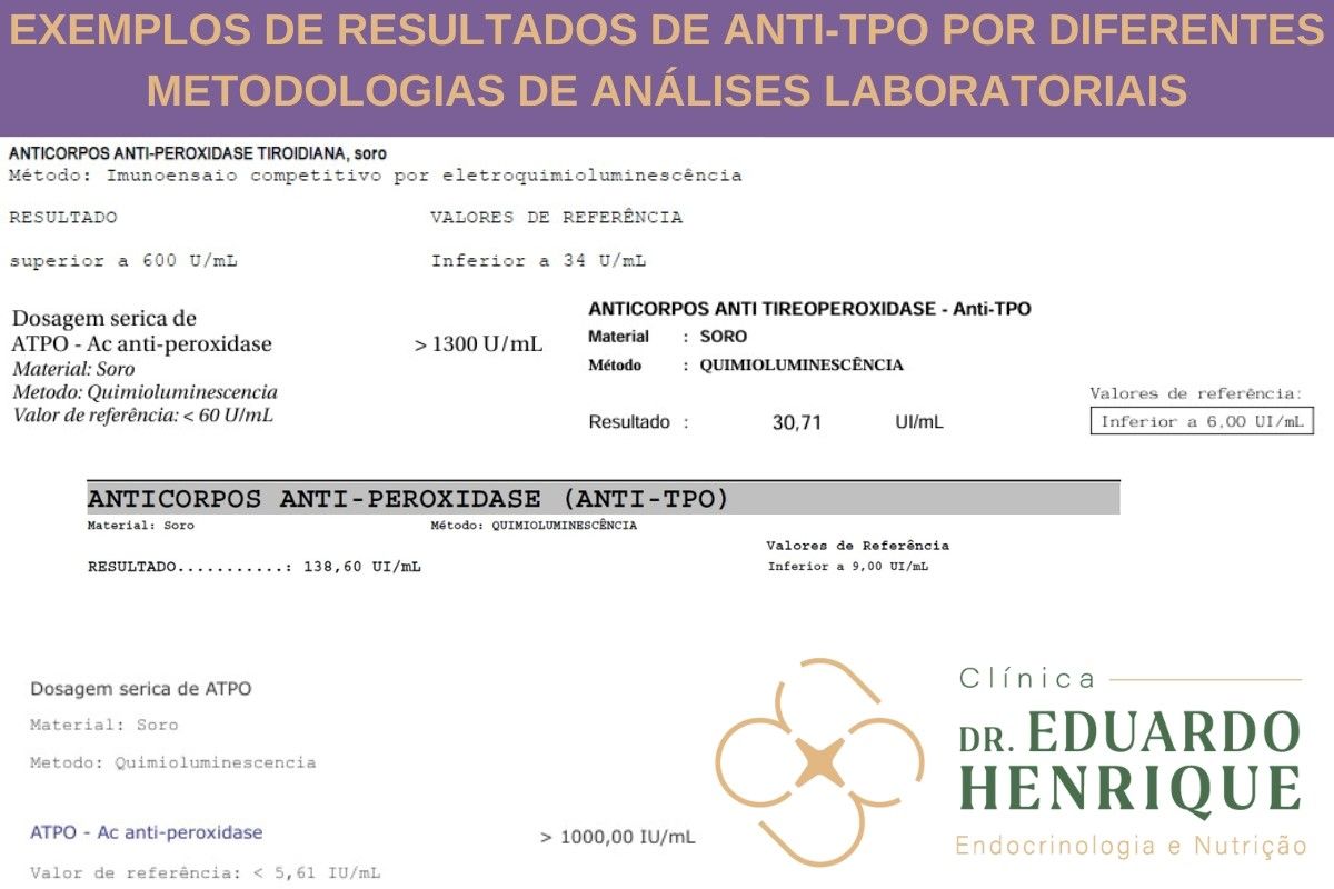 Exame de Anticorpos Antiperoxidase (Anti-TPO): descubra como ele pode ...