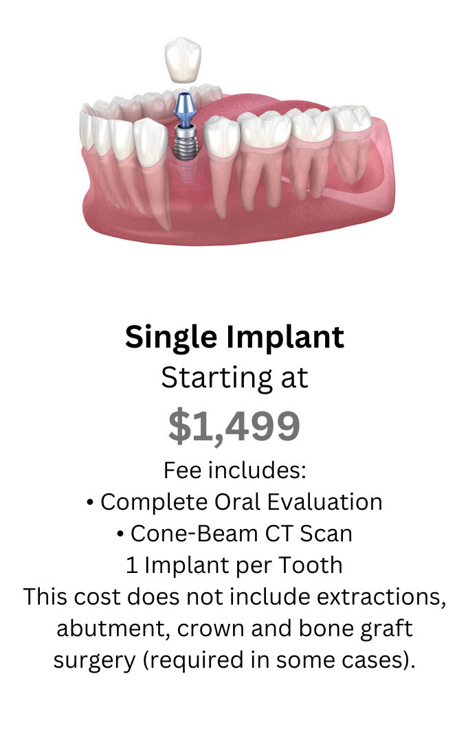 SINGLE TOOTH IMPLANTS IN STAMFORD,CT