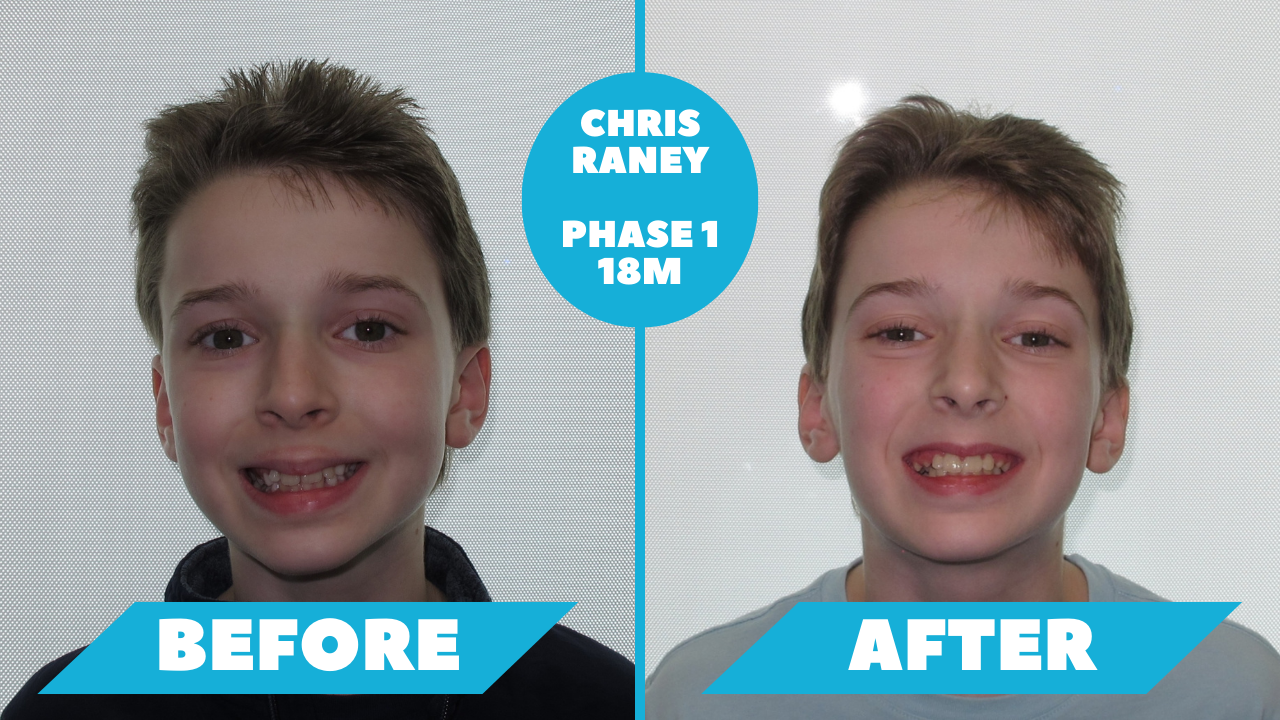 Patient Spotlight: Chris Raney