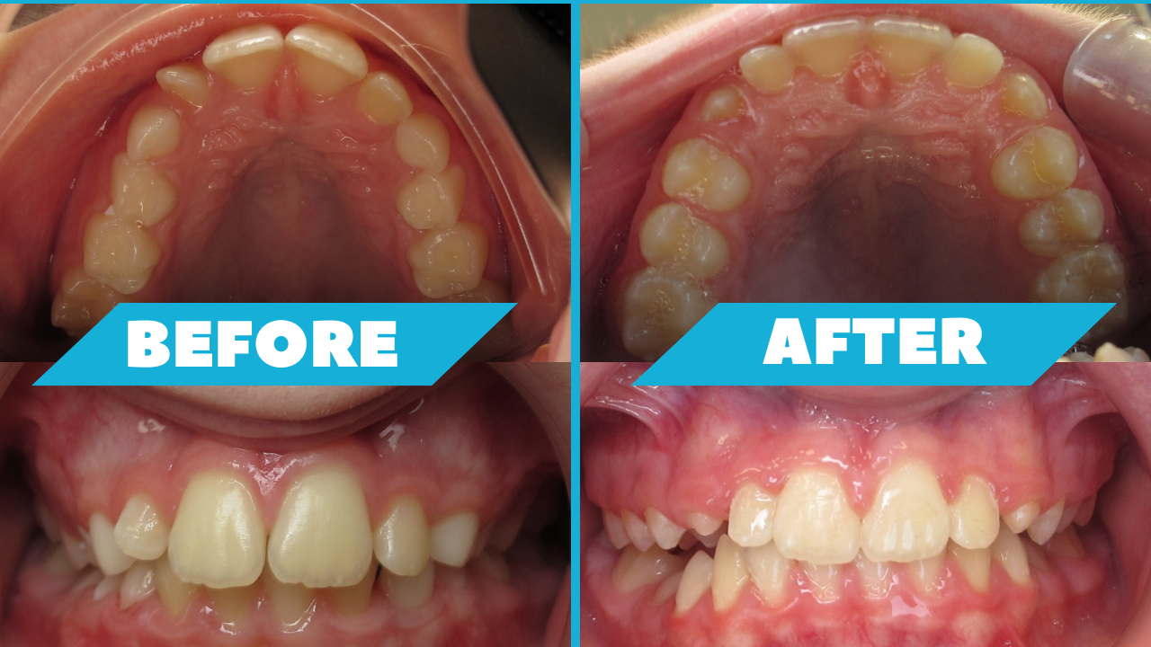 Patient Spotlight: Chris Raney