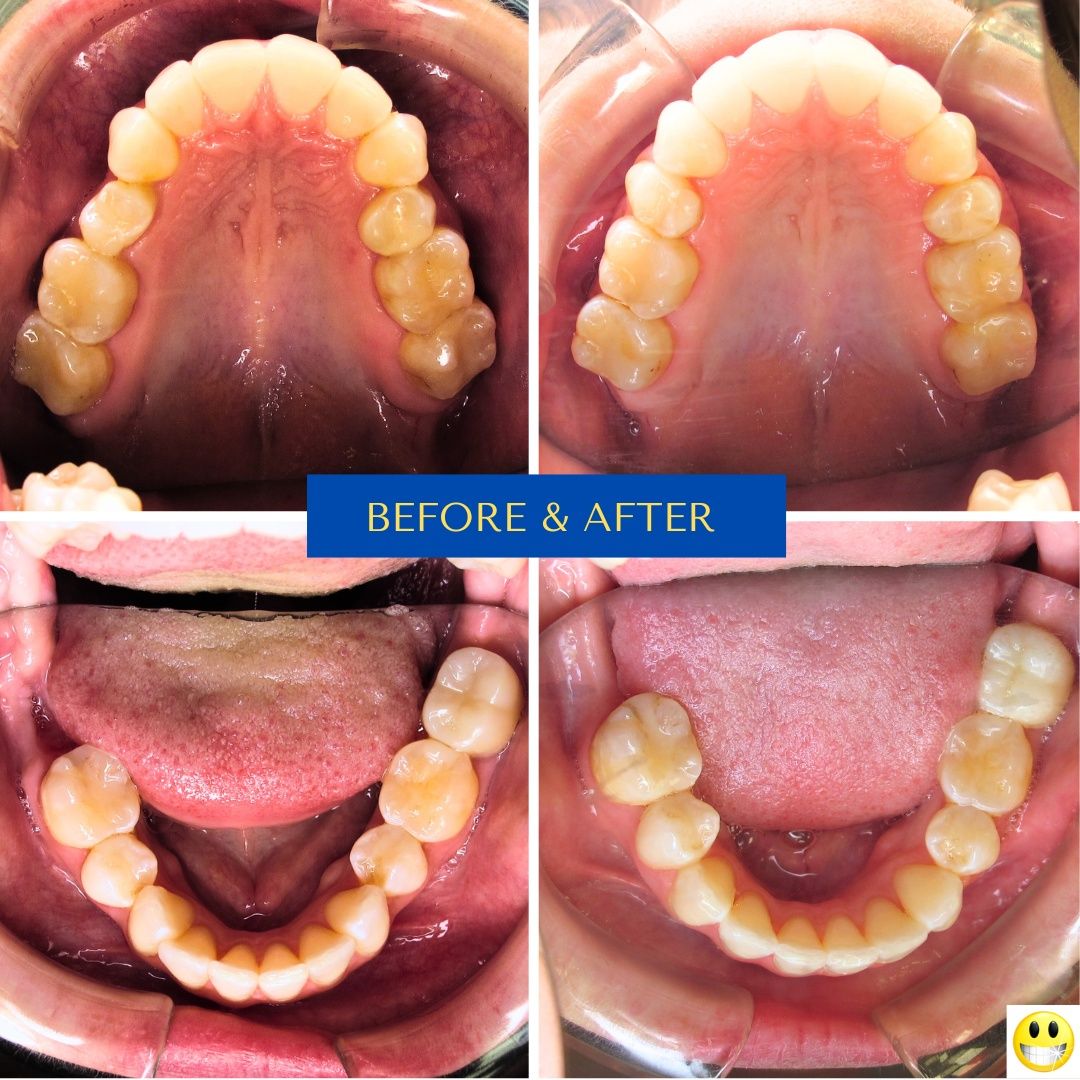 May Patient Spotlight: Katie