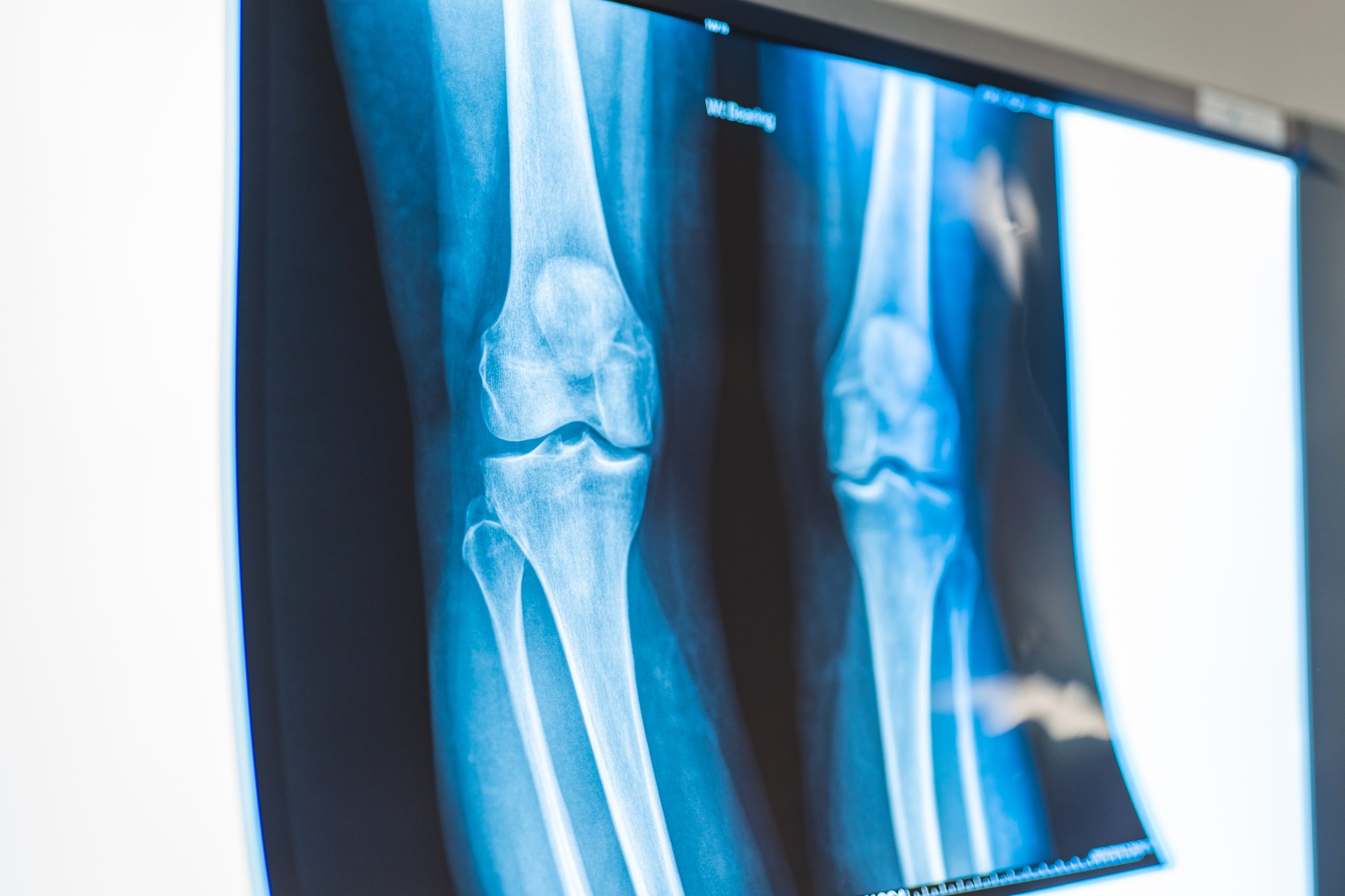 Orthopaedics Toowoomba | Home