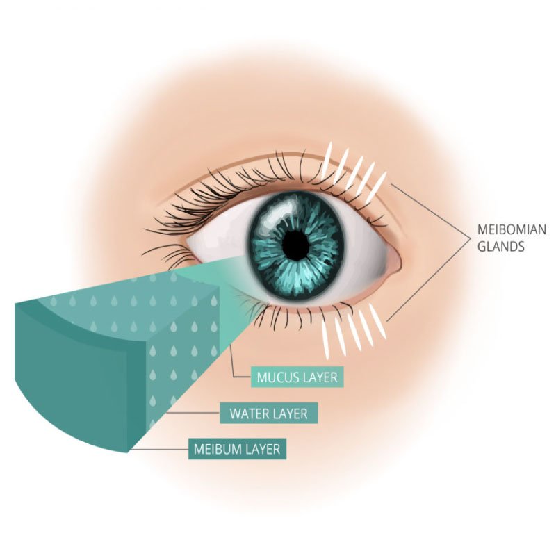 Dry Eye Disease | Urban Optiks Optometry