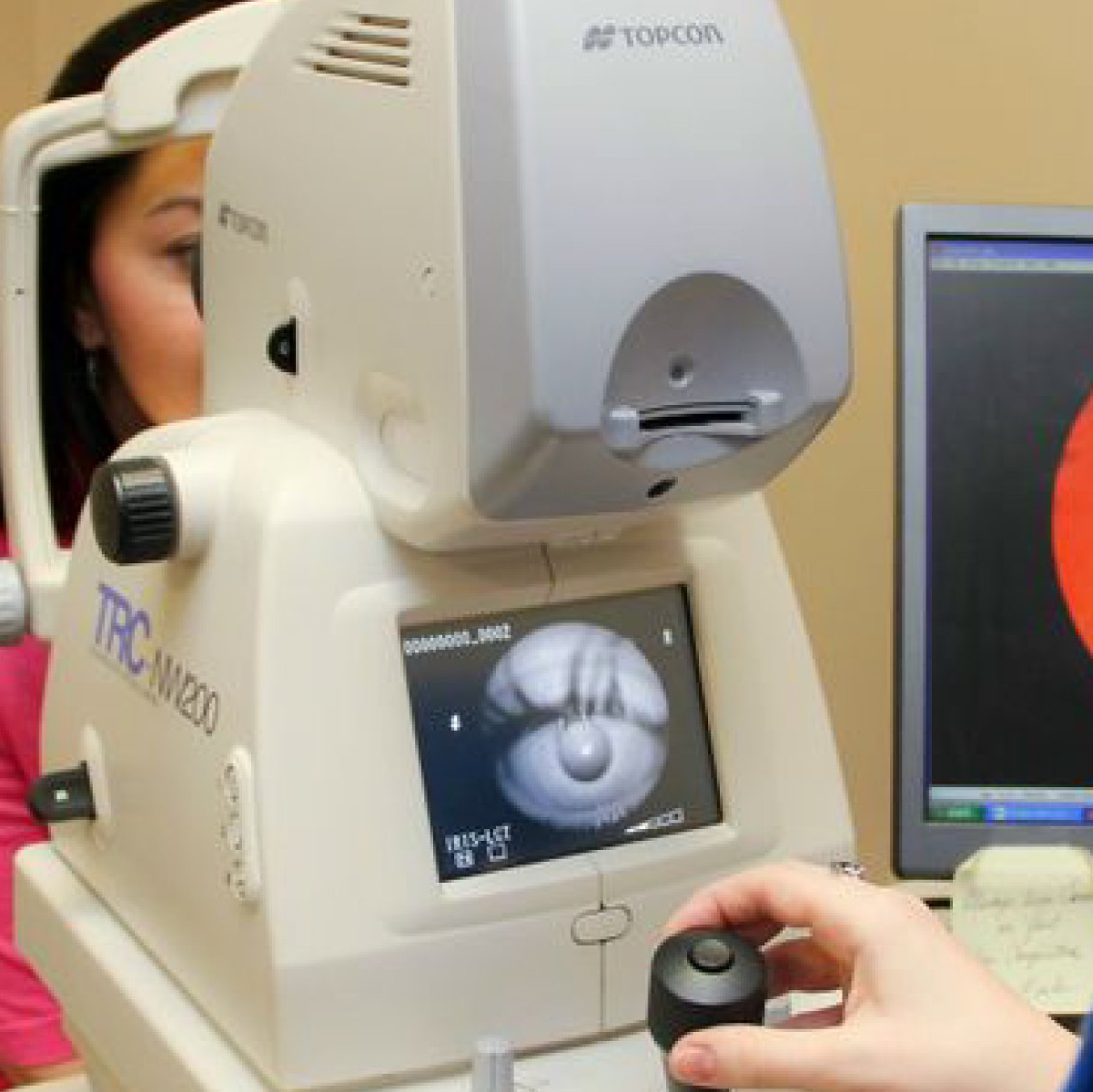 Retinal Imaging | Urban Optiks Optometry
