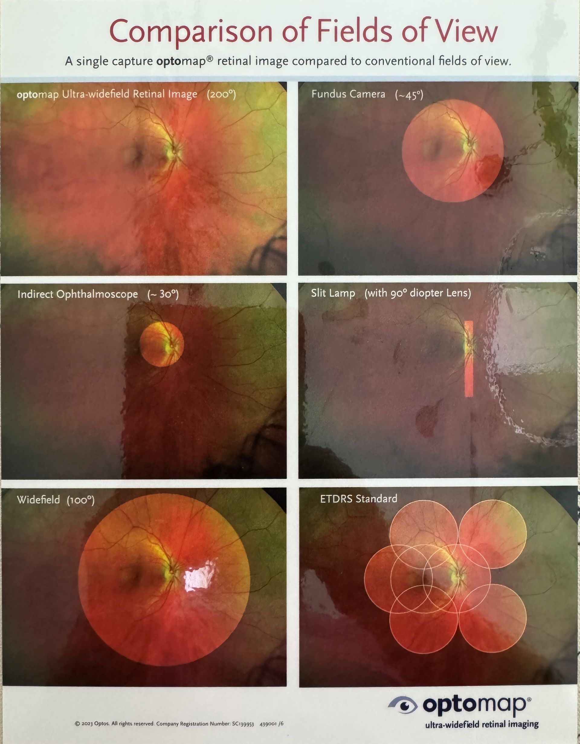 Optomap Exams | Rocky Mount, NC | Rocky Mount Eye, P.A.